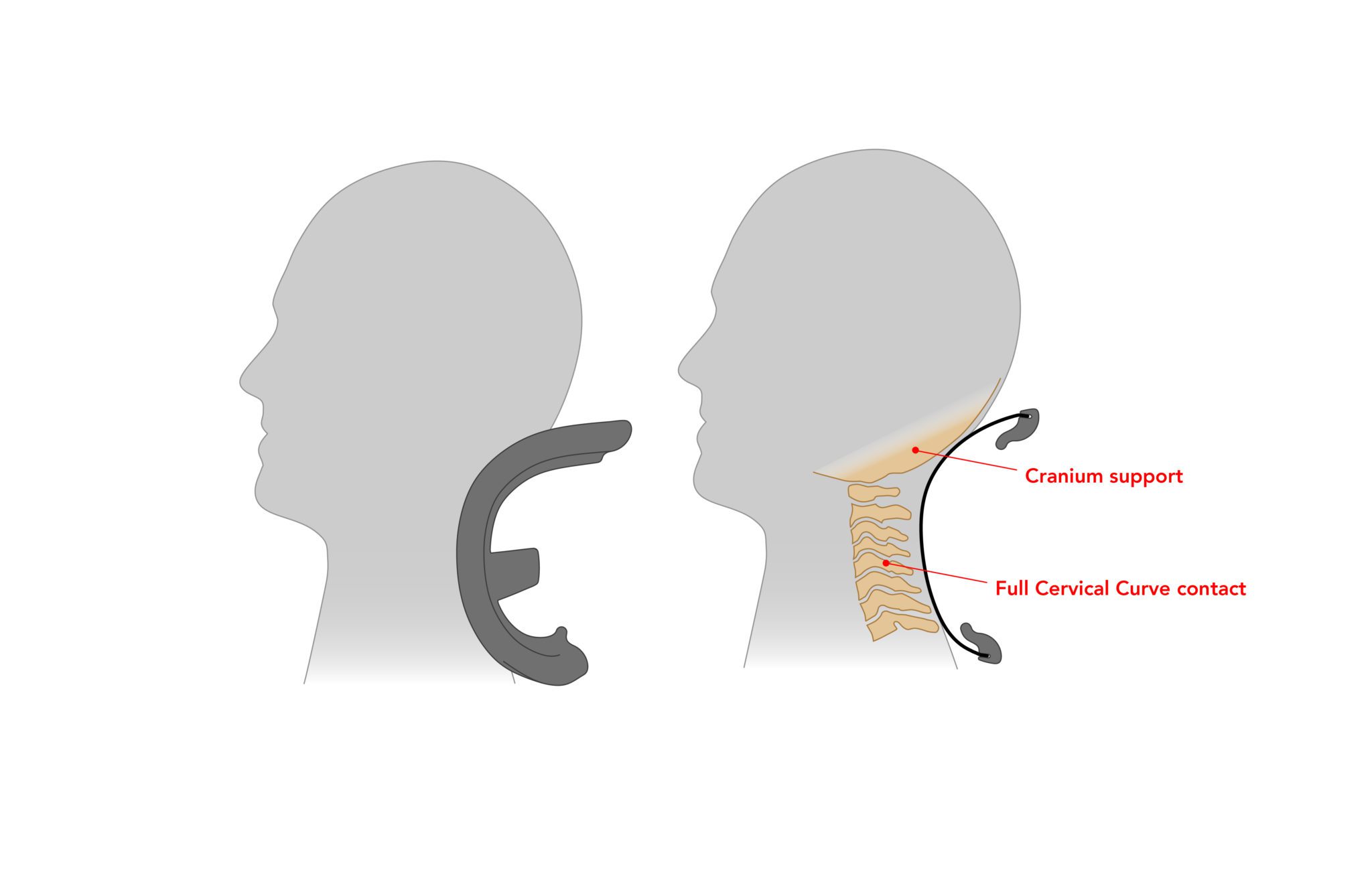 Aeron Headrest Comparison - Engineered Now versus Atlas